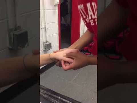 Watson test for scapholunate instability - YouTube