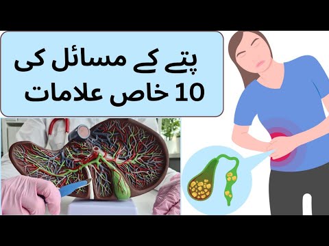 Pita kharab hone ki alamat l Gallbladder symptoms in Urdu/Hindi l Pitte ...