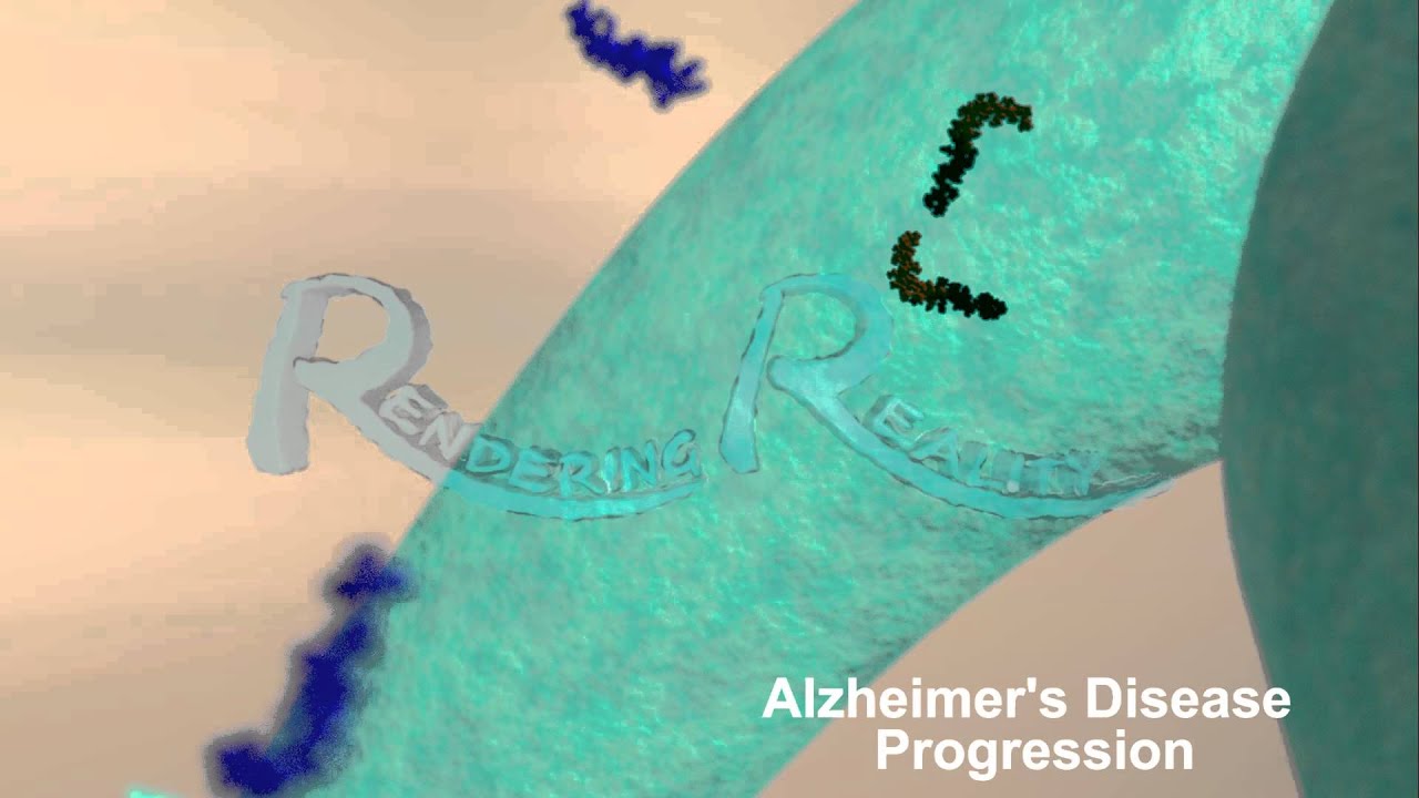 Amyloid Beta 42 peptide (AB42) - 2 - YouTube