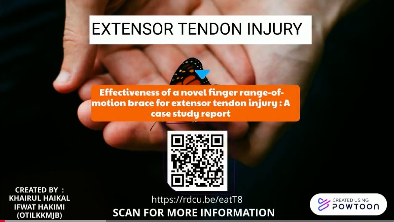 EXTENSOR TENDON INJURY (HAIKAL : IFWAT ) MODIFIED - YouTube