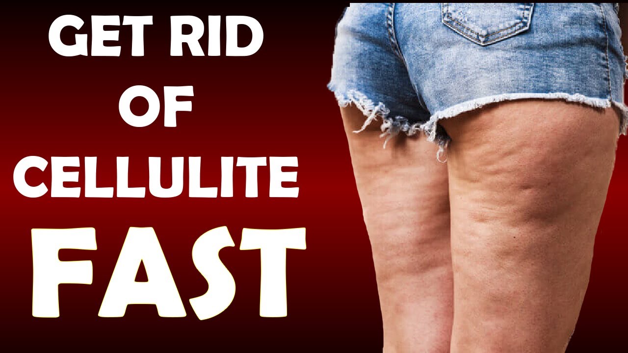 How to Lose Cellulite on Thighs & Buttocks Fast! | STOP BUYING ...