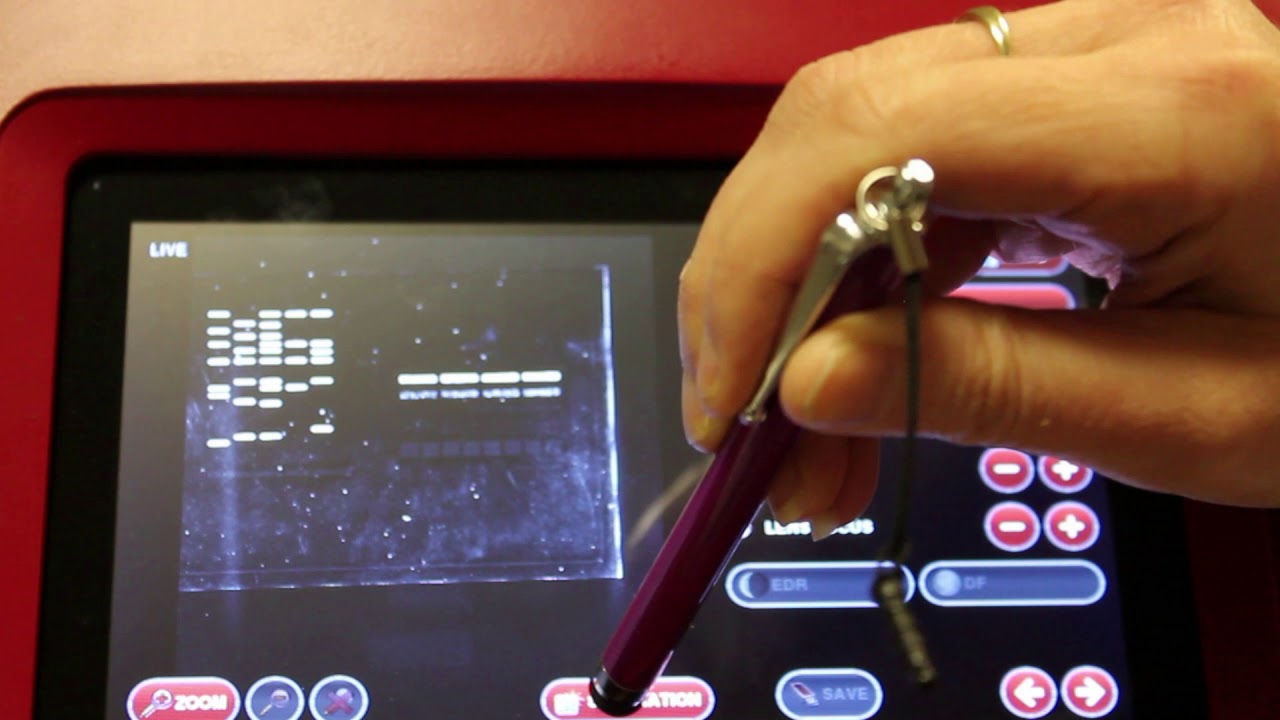 NuGenius gel imaging system from Syngene - YouTube