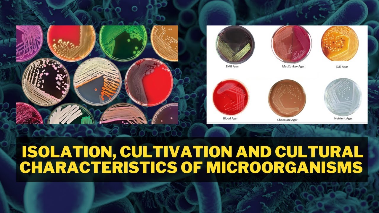 Isolation, Cultivation and Cultural Characteristics of Microorganisms ...