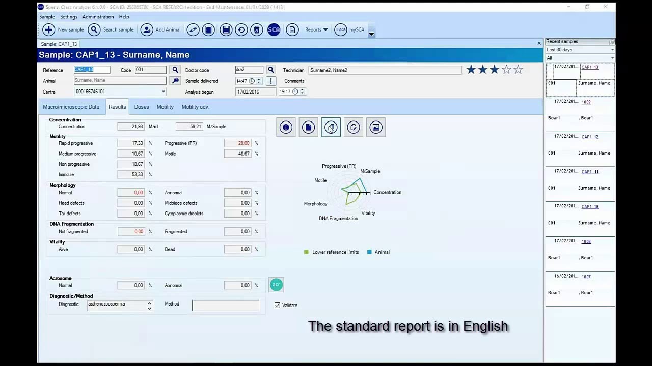 SCA Tutorial - Report language - YouTube