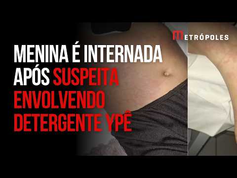 Menina de 10 anos luta contra infecção após contato com detergente Ypê