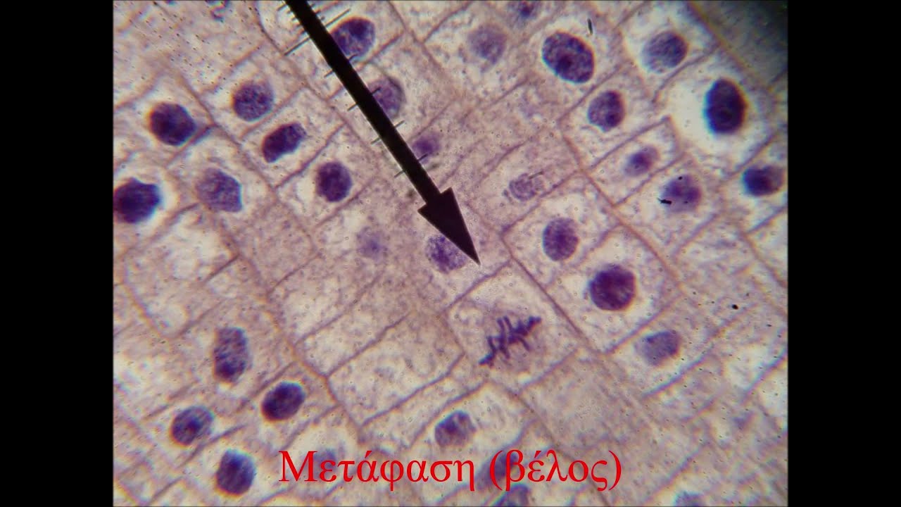 Εικόνες μικροσκοπίου 5 - στάδια μίτωσης - ΕΚΦΕ Κιλκίς - YouTube