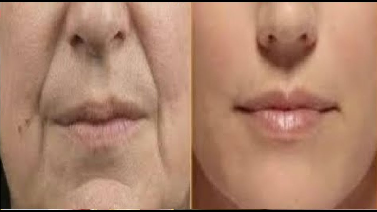 TIREI DO LIXO E PASSEI NA BOCA E NUNCA + AMASSOU | LEVANTA BOCA MURCHA ...