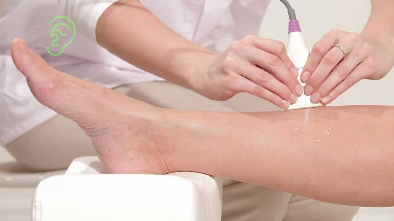 Osteoporosis Assessment by Measuring the Tibia - YouTube