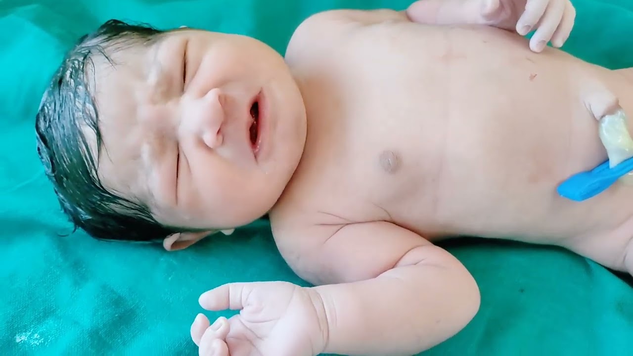 3 kg and 300 grams baby girl # 38 weeks gestation # Via C- Section ...