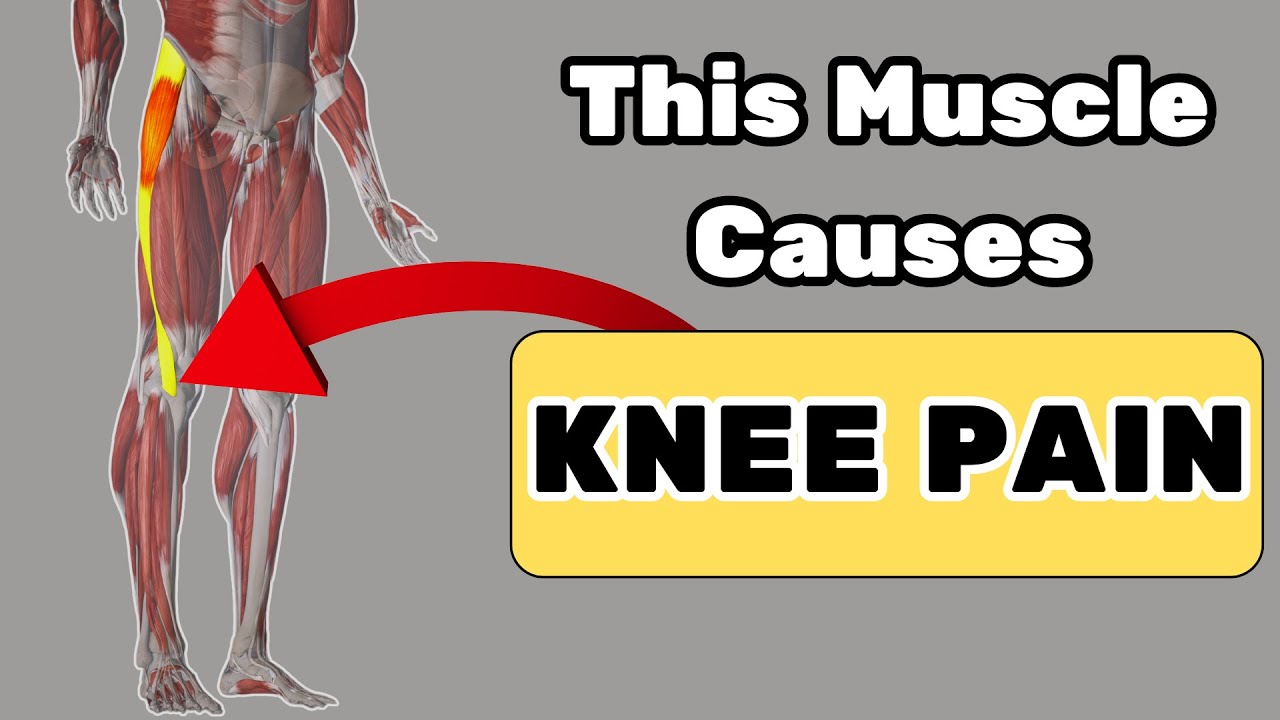 This muscle causes knee pain 🦵 - YouTube
