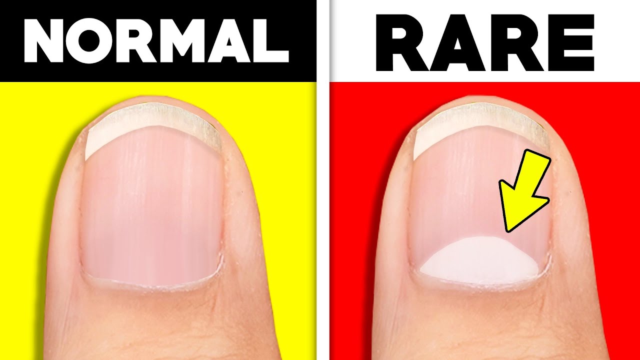 6 Signs You're Actually Normal.. - YouTube