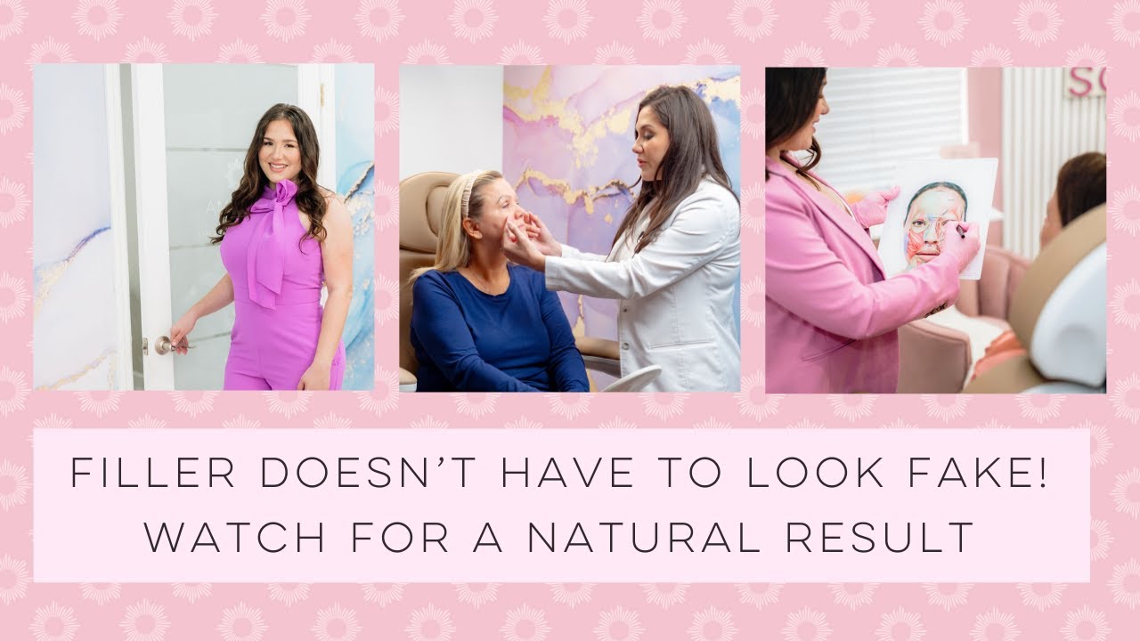 Fillers Don't Make you Look Fake - Watch Full Face HA Filler - YouTube