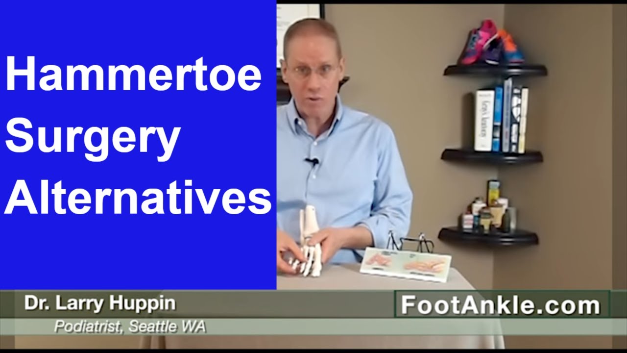 Watch This Video Before Having Hammertoes Surgery – Seattle Podiatrist ...