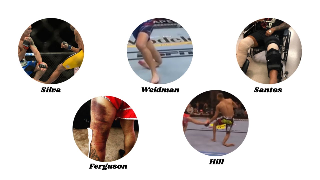 The Most Painful Leg Injuries in UFC - YouTube