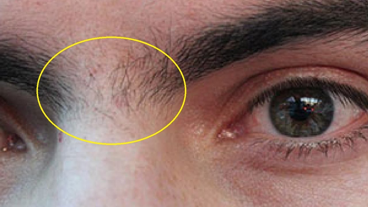 how to get rid of unwanted eyebrow hair permanently - YouTube