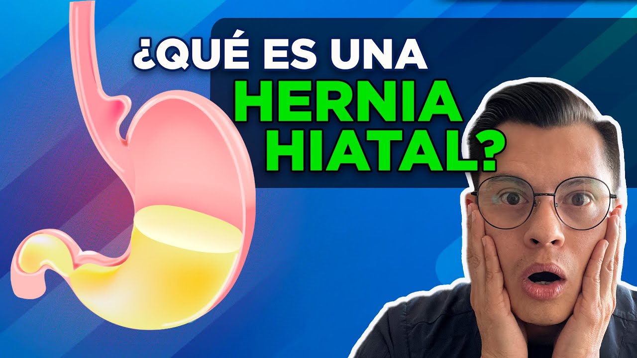 ¿QUÉ ES UNA HERNIA HIATAL? - YouTube