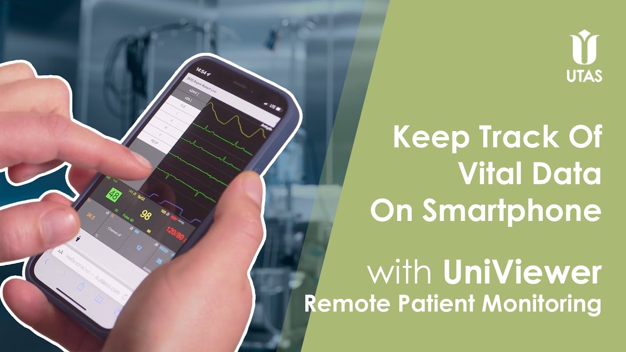 UniViewer — remote monitoring of vital data with UM 300 Patient ...