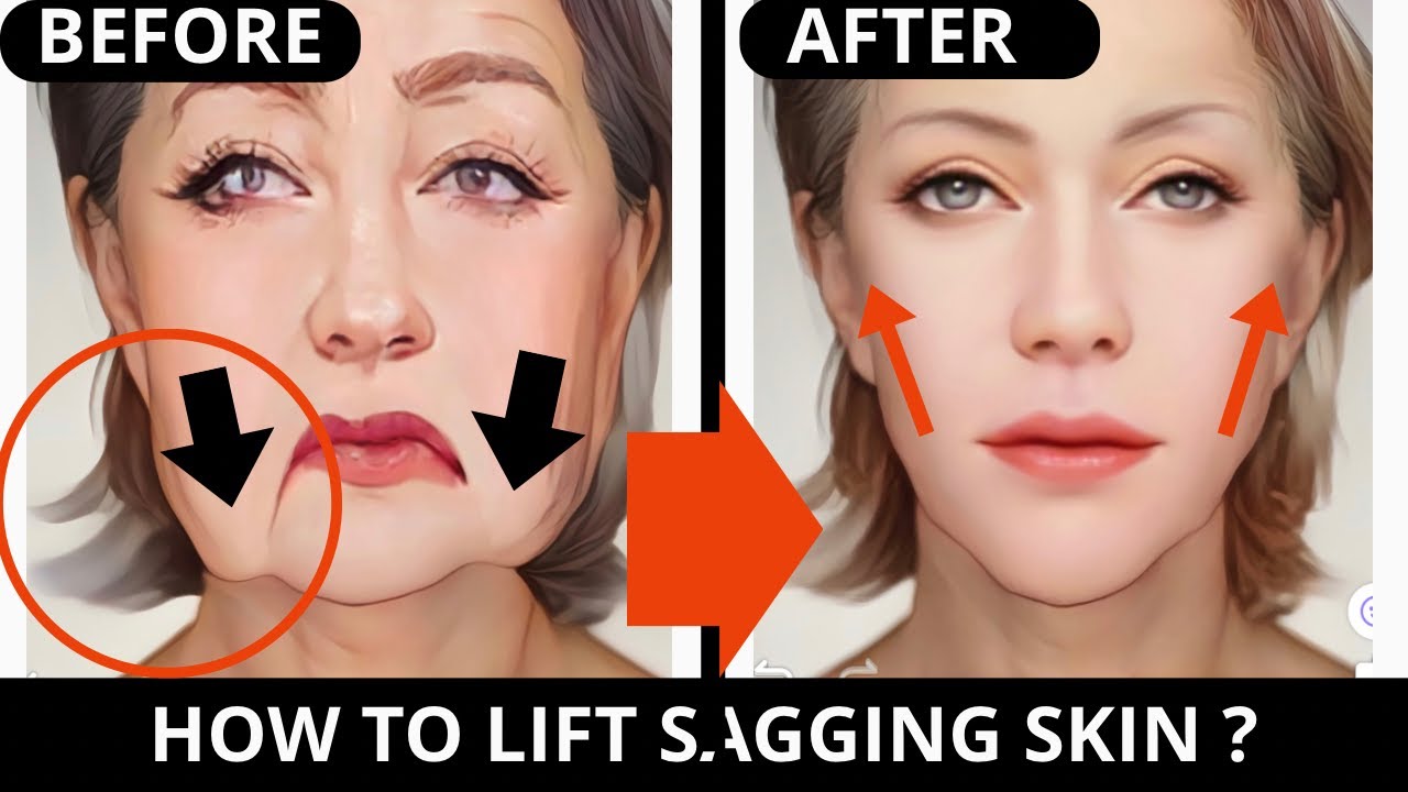 🛑 ANTI-AGING EXERCISES FOR SAGGING SKIN, JOWLS, LAUGH LINES, FOREHEAD ...