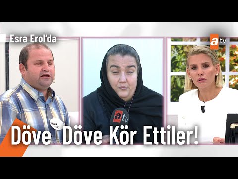 Yaşar dilenci mafyasının eline düşüp işkence gördü! - @EsraErolatv 14 Eylül 2022
