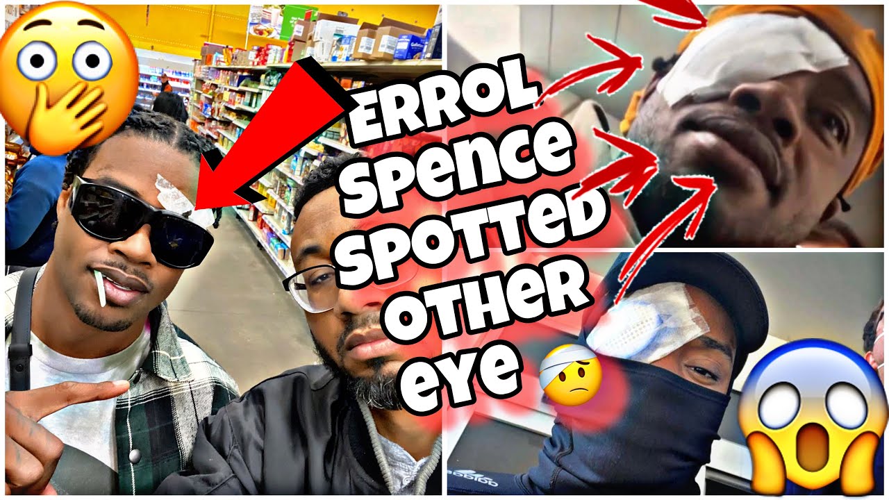 ERROL SPENCE JR SPOTTED LEFT EYE BROKEN TOO NOT JUST RIGHT EYE 👁️ IS HE ...