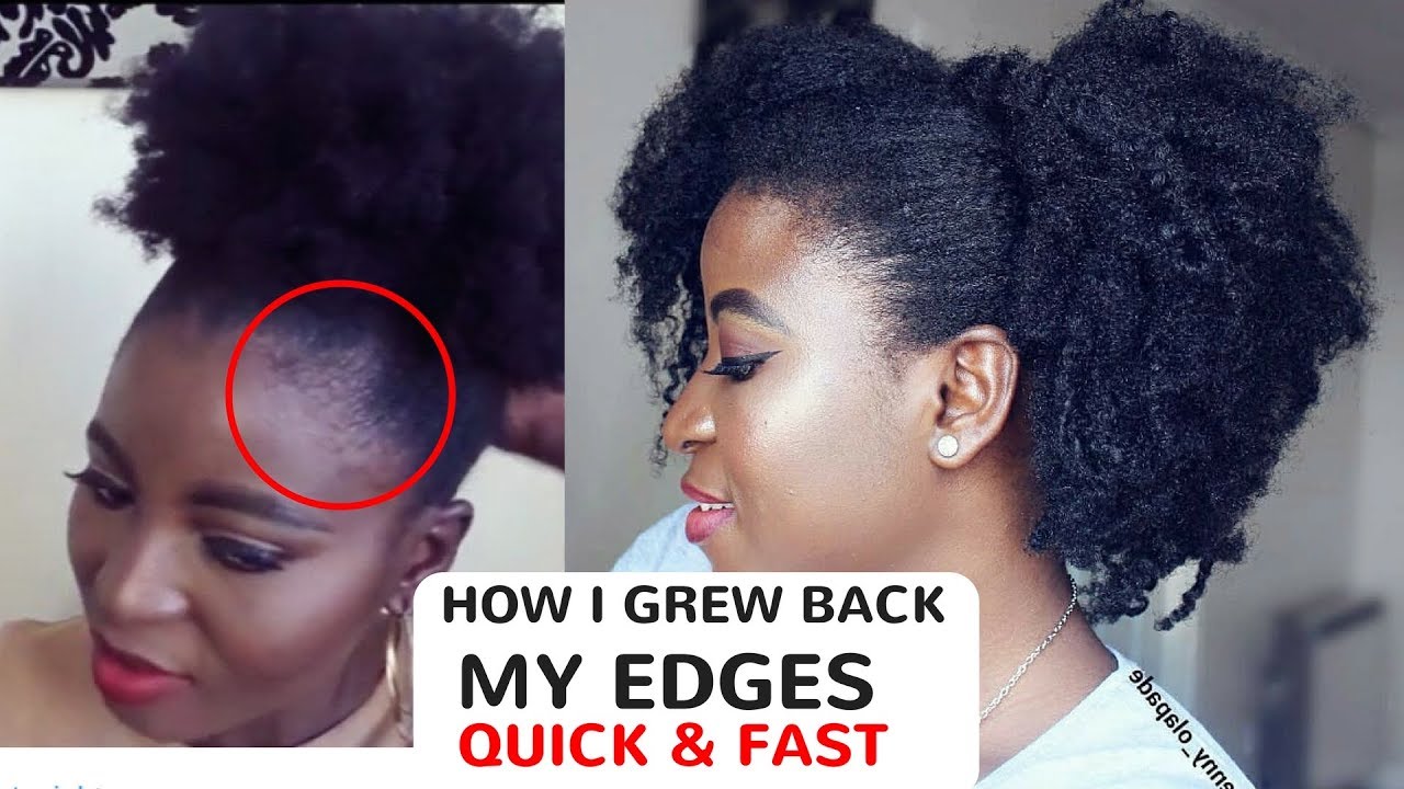 HOW I DESTROYED MY EDGES + HOW I GREW IT BACK QUICK & FAST | Kenny ...