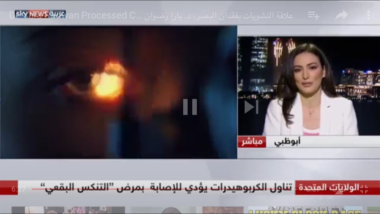 علاقة النشويات بفقدان البصر، د. يارا رضوان Dr. Yara Radwan Processed ...