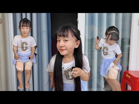 Ut Mini Chia Sẻ Trải Qua Ca Phẫu Thuật Thay Đổi Khuân Mặt. 