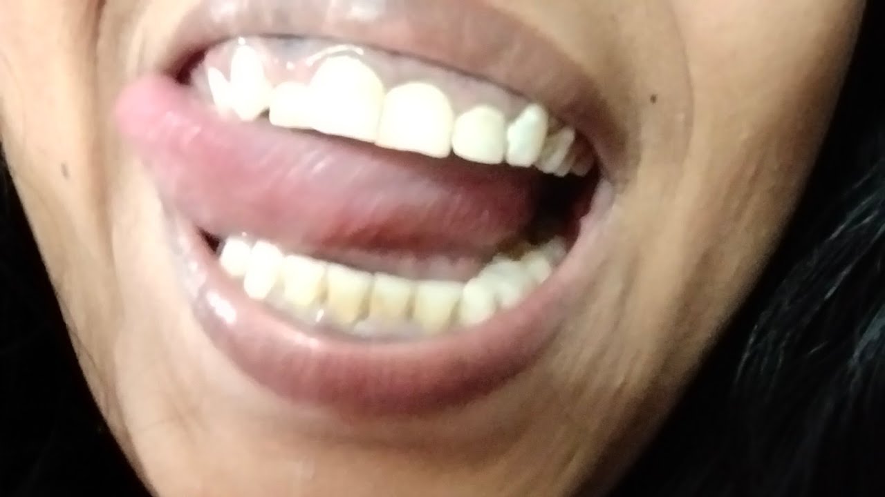 Mouth tour & exercise twice challenged||funny video || 😬😂 @piyali life ...