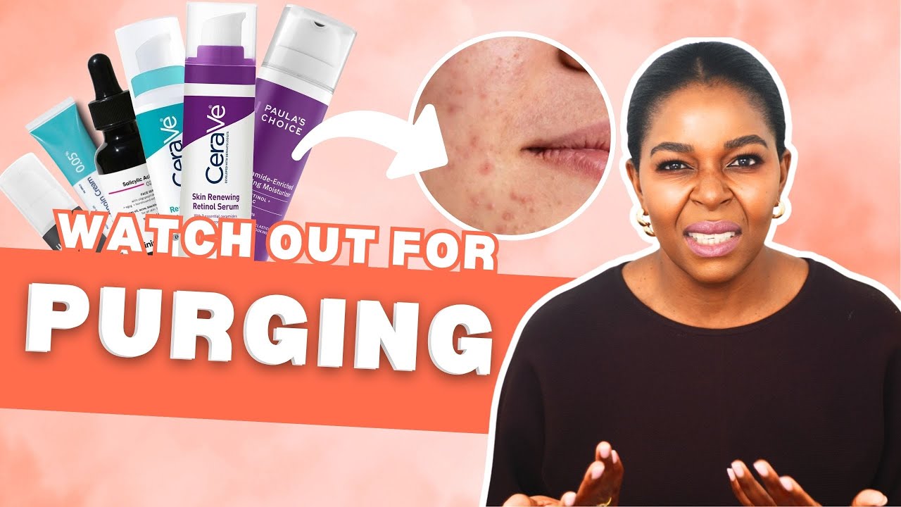 Skin Purging, What It Really Is (And How to Tell It’s NOT a Breakout ...