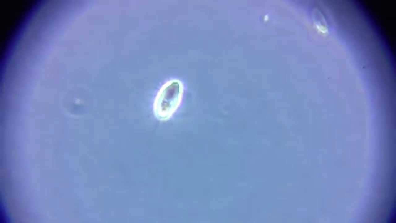 Cyclidium sp. - YouTube