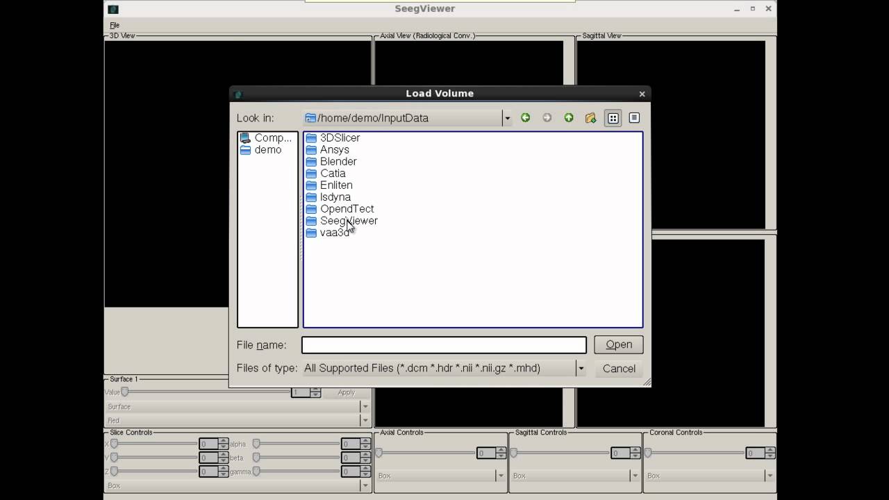 EnginFrame Views and DCV for Biomedical Applications - YouTube