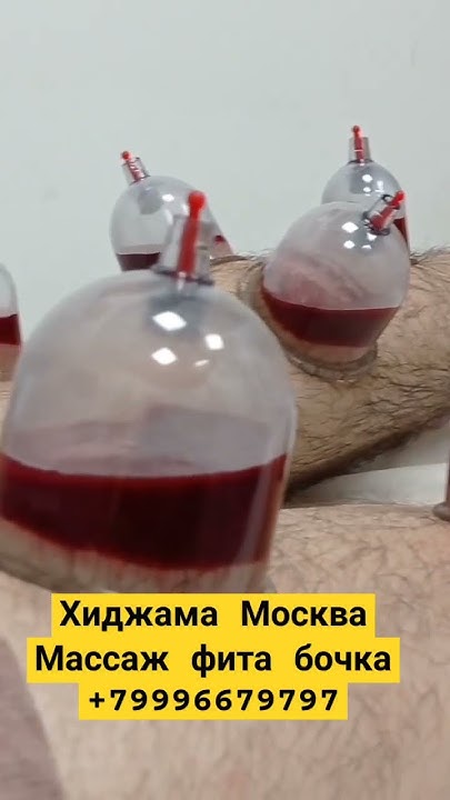 Хиджама массаж фита бочка мануальная терапия ☎️+79996679797 - YouTube