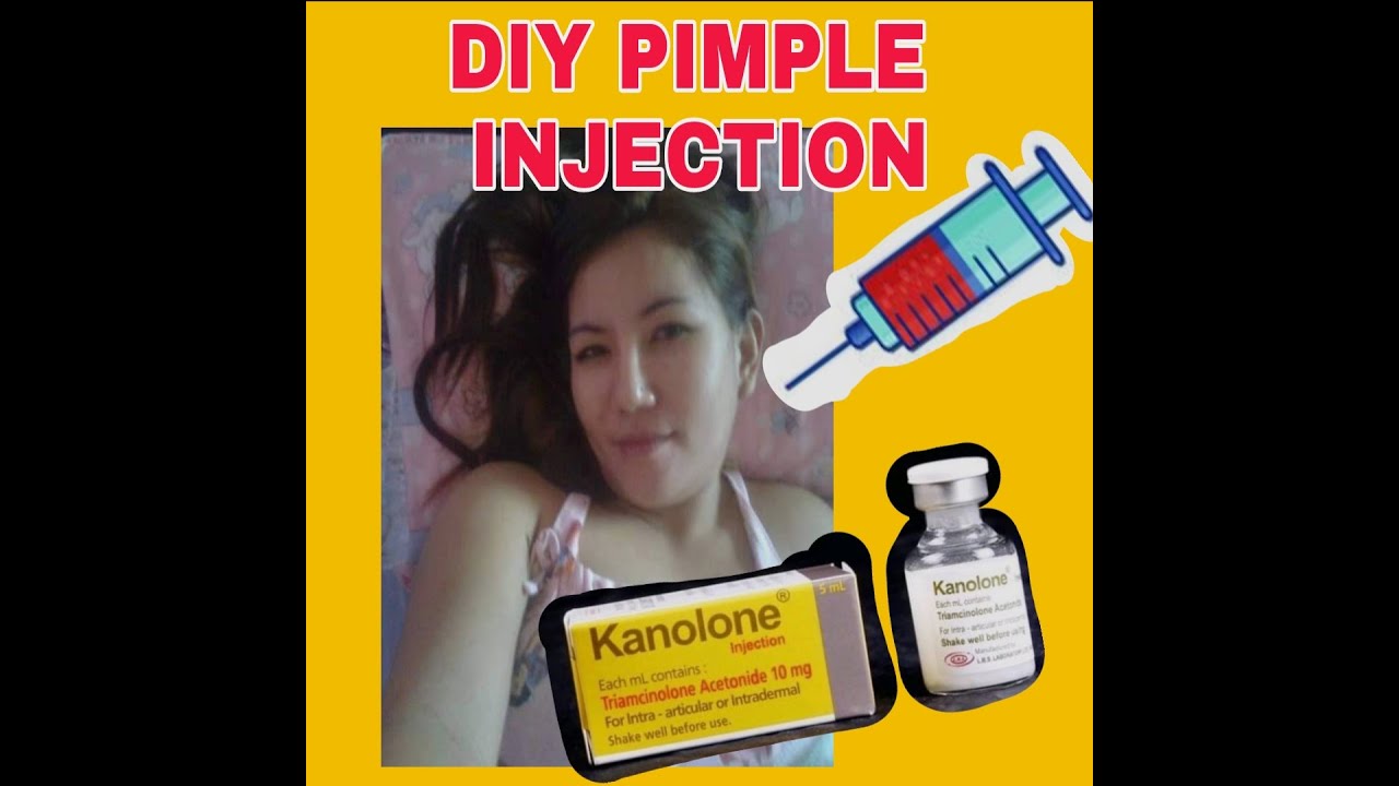 Mabilis Pantanggal ng Acne ( kanolone injection ) - YouTube