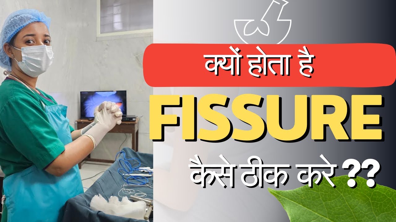 ANAL FISSURE क्यों होता है ? || ANAL FISSURE | ayurveda treatment ...