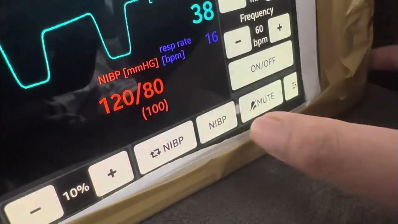 NIBp measure - YouTube