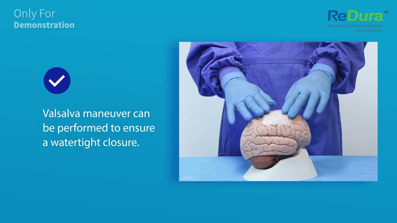 ReDura™ Biomimetic-Synthetic-Absorbable DuraI Substitute - YouTube