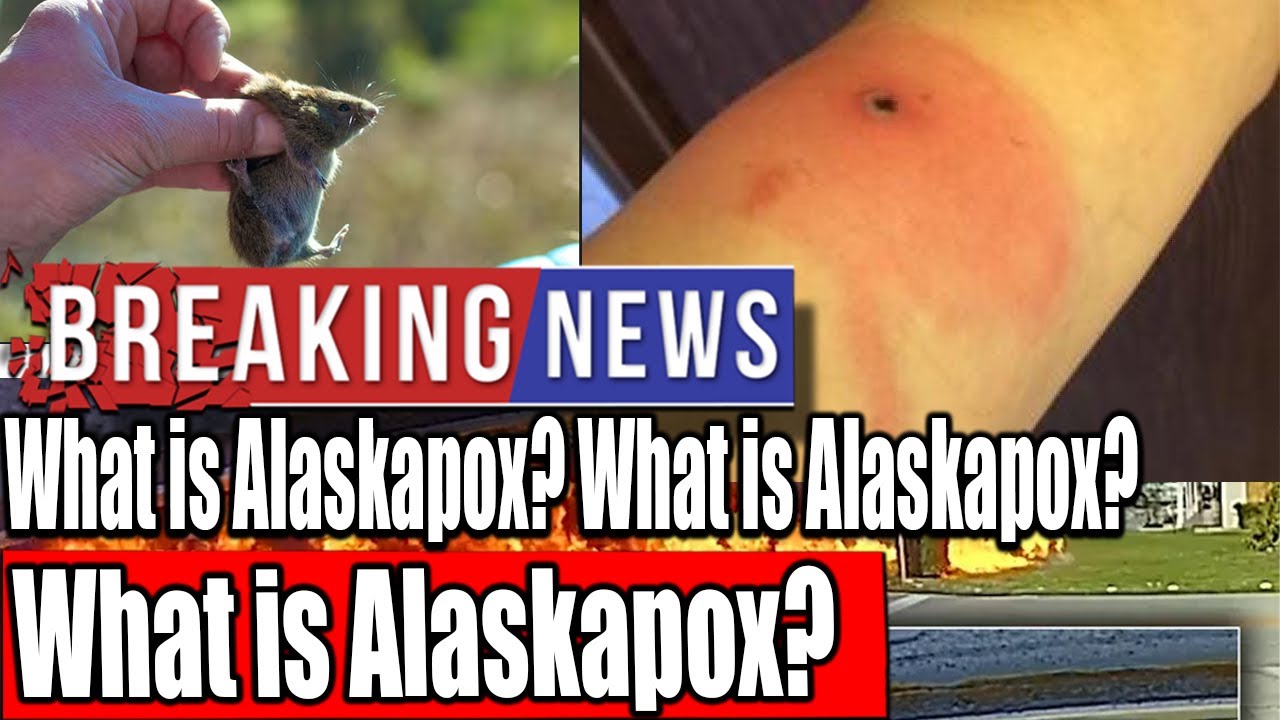 Alaskapox Claims One Life in US: Origin Symptoms Of Unusual Viral ...