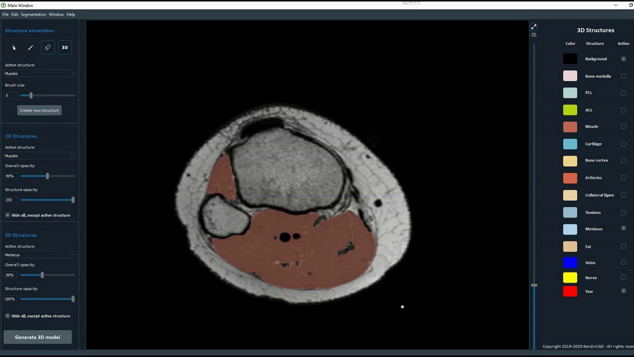 Annotatio sound test 0 - YouTube