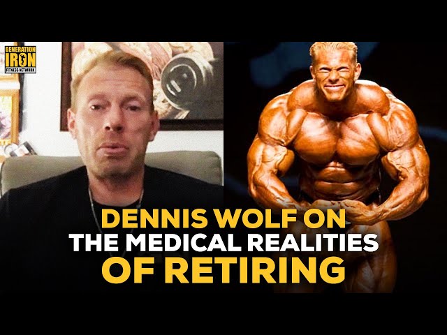 Dennis Wolf Calves Problem