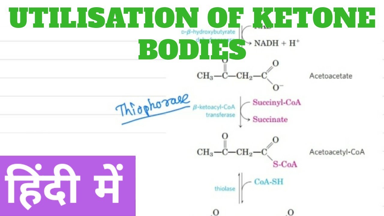 Formation Of Ketone Bodies
