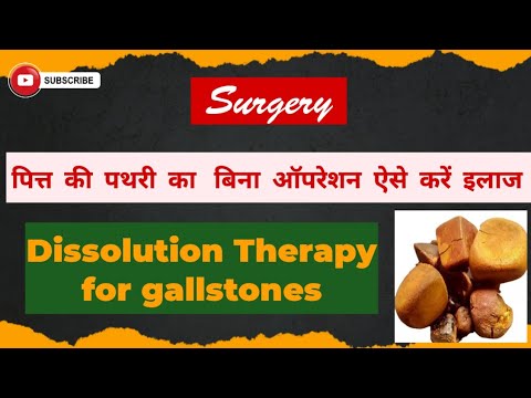 ||gallstones disease ||dissolution therapy for gallstones ...