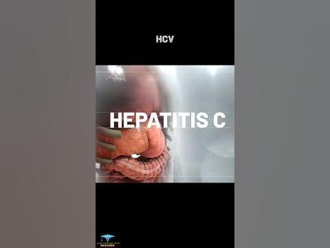 Hepatitis C - YouTube