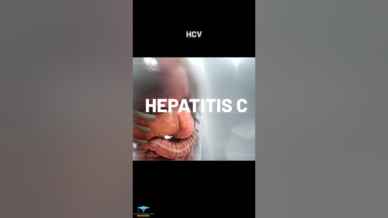 Hepatitis C - YouTube