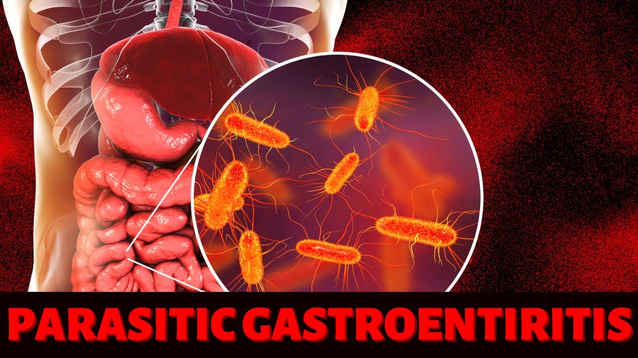 PARASITIC GASTROENTIRITIS - YouTube