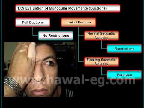 Strabismus: Evaluation of Monocular Movements (Ductions) - YouTube
