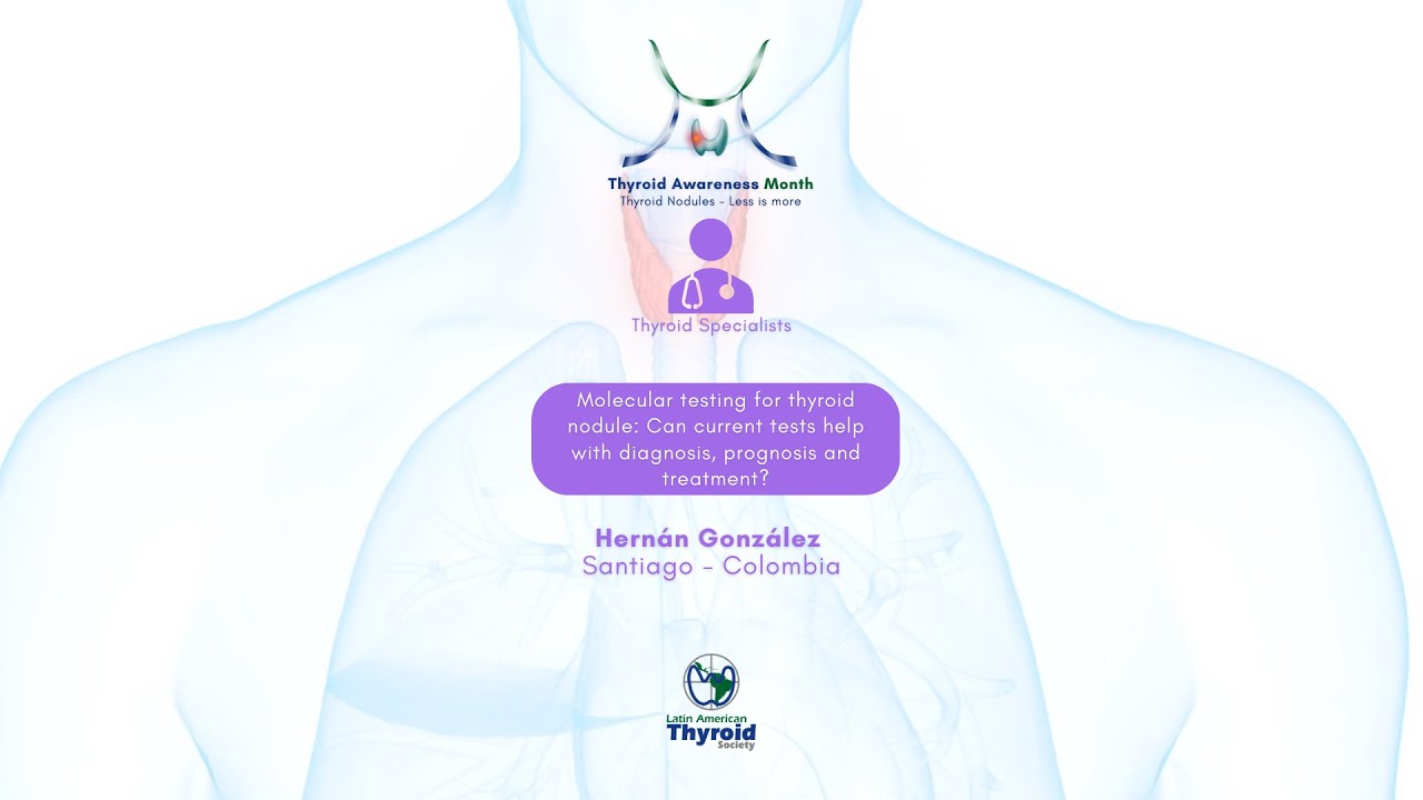 Thyroid Nodules 3022