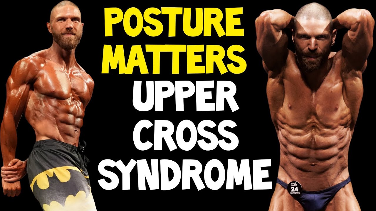 PRVENTION and TREATMENT STRATEGIES for Upper Cross Syndrome | What is ...
