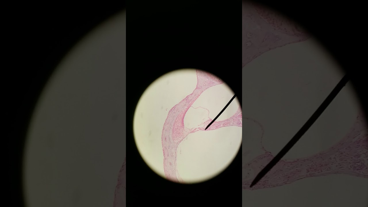 Hair cells cochlea auditory histology - YouTube