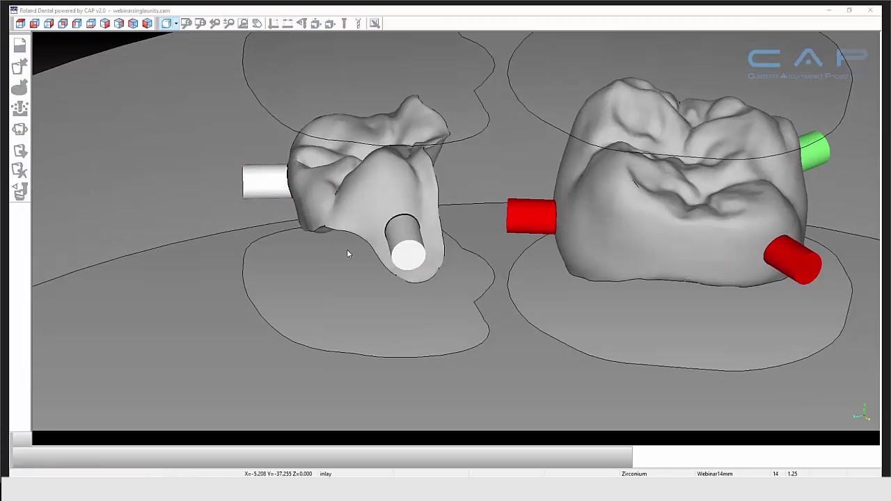 Spruing 101: Best Practices by Restoration Type - YouTube