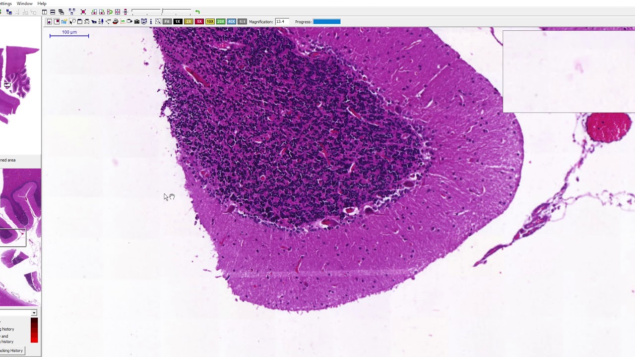SWU Pathology: Neuropathology: Rabies - YouTube